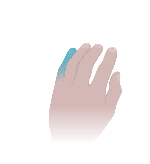 Hand position 1 for a