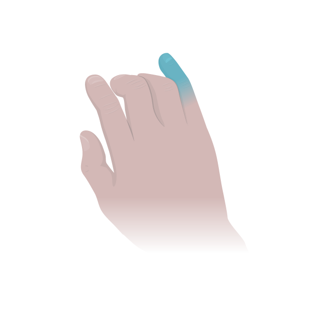 Hand position 1 for p